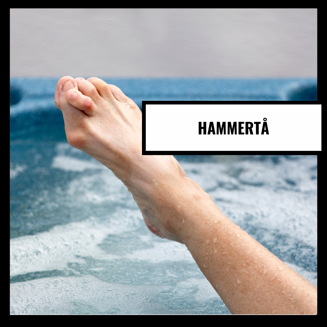 Hammertå | Sko og sandaler med ekstra plads og aflastning ...